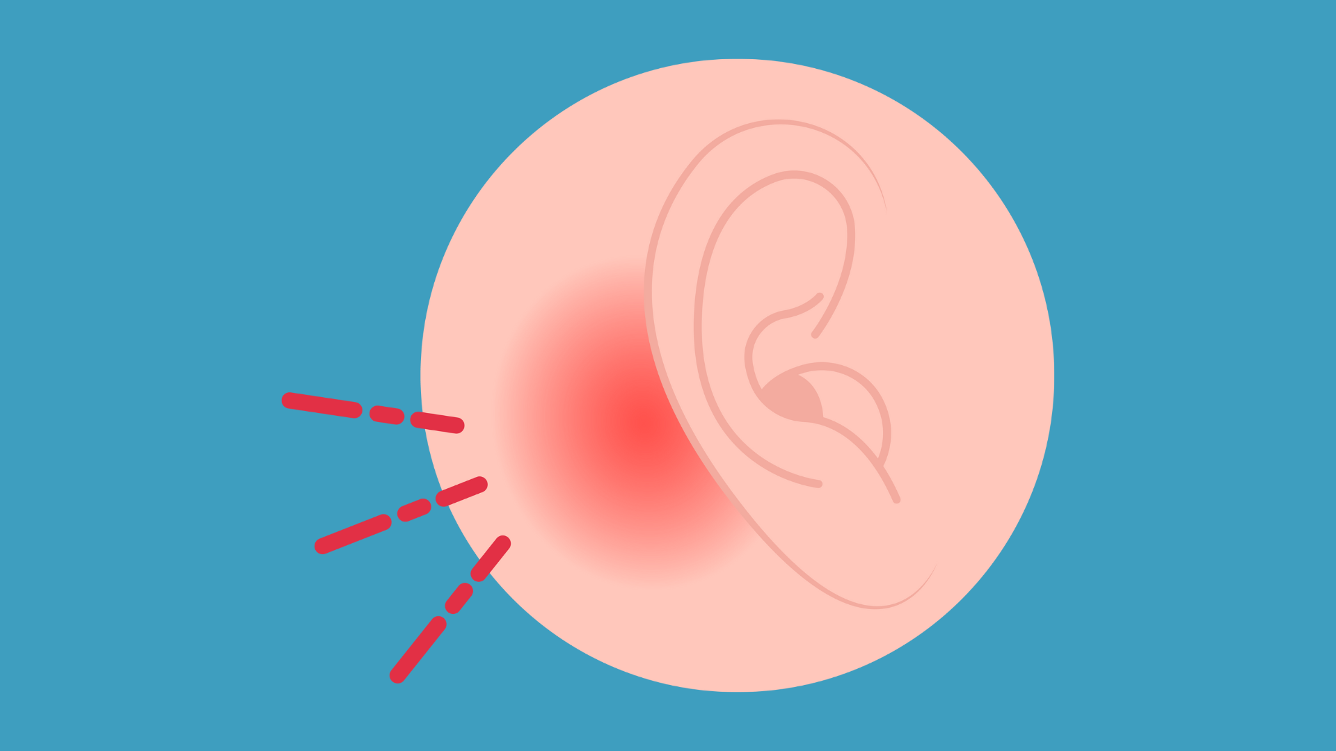 Physiotherapy for vertigo: Regaining balance and control